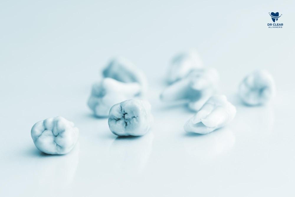 Tooth Extractions Treatment | Dr Clear Aligners Singapore