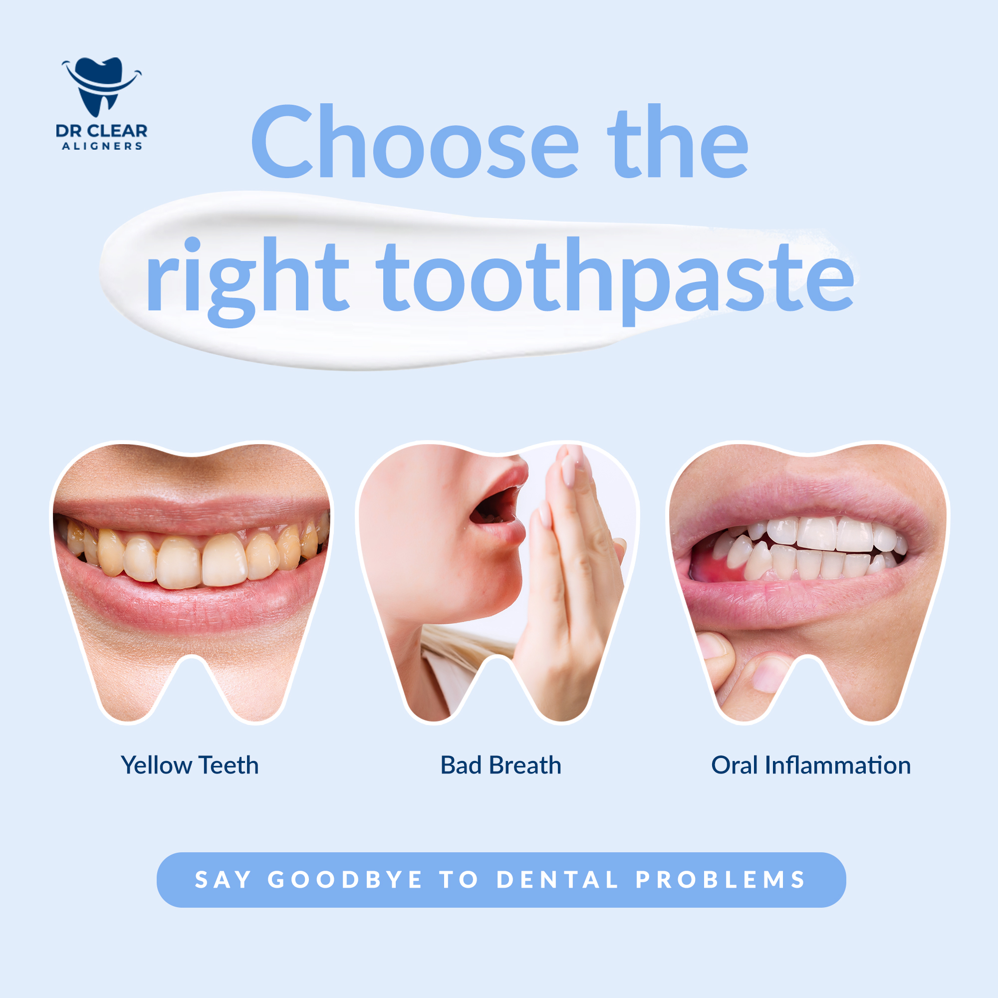 Dr Clear Aligners Spearmint Toothpaste - Dr Clear Aligners Singapore